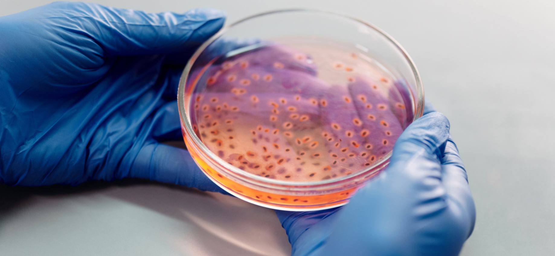 Vancomycin-resistente Enterokokken (VRE-Keim) - colitisblog.de